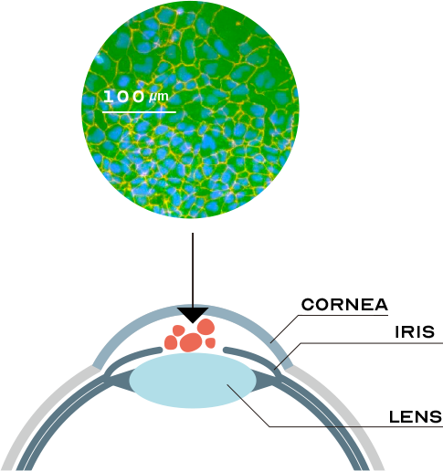 CELLUSION - Cellular technology breakthrough for clear vision of the ...